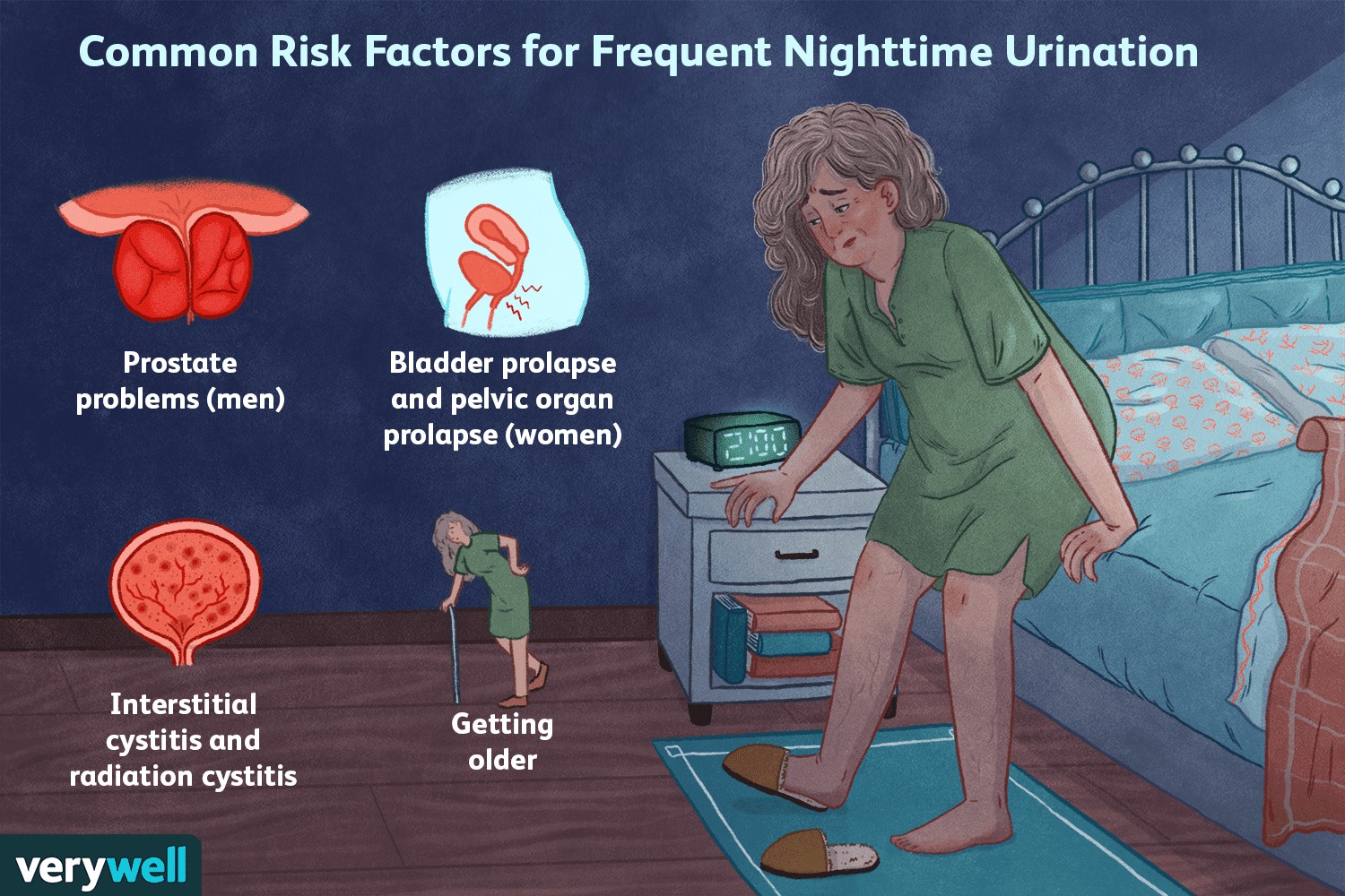 Nocturia: All you need to know - symptoms, diagnosis, treatment and ...
